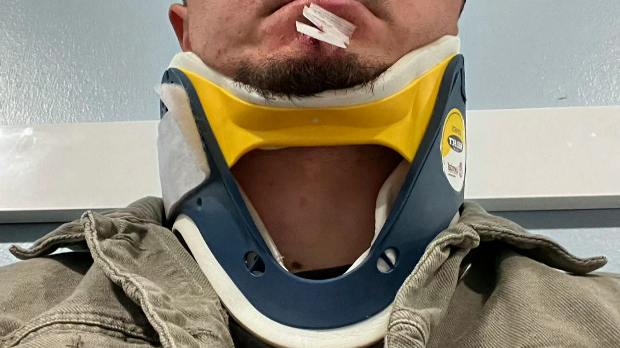 RTS :: Region :: Čović otkriva u kakvom su stanju povređeni u Zadru ...